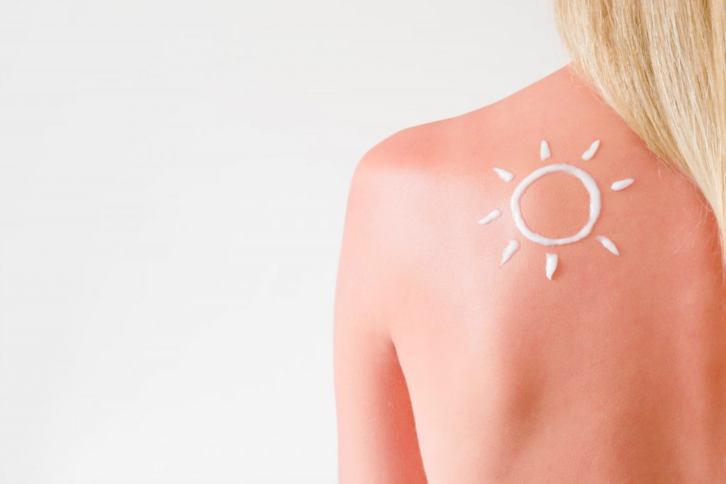 Eritema solare: sintomi, fattori di rischio e cure. | Sfera